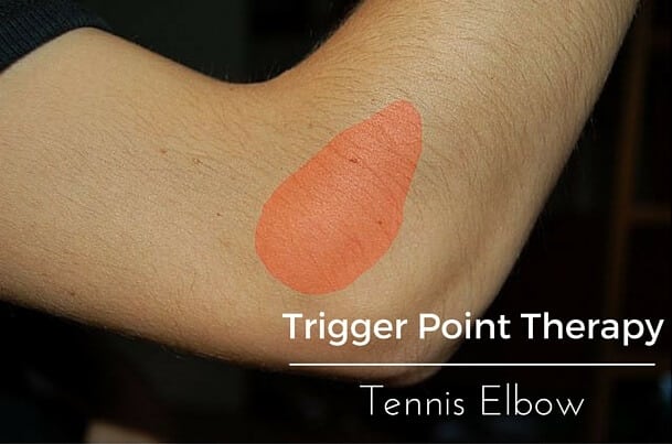 Trigger Point Therapy Tennis Elbow - For Your Massage Needs
